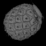 Download FREE CT Scans, X-rays & More - Disect Revisited