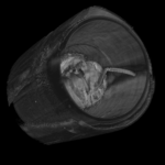 Download FREE CT Scans, X-rays & More - Disect Revisited